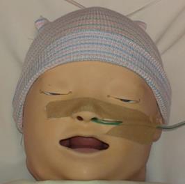 Inbrengen van een maagsonde - Patiëntenfolder - Erasmus MC