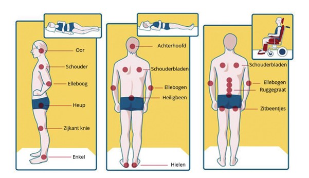 Hoe u doorligwonden (decubitus) kunt voorkomen - Patiëntenfolder ...