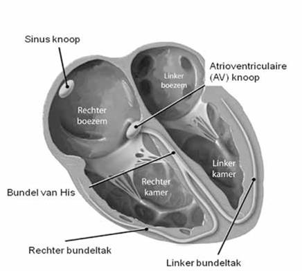 Elektrofysiologie - Patiëntenfolder - Erasmus MC