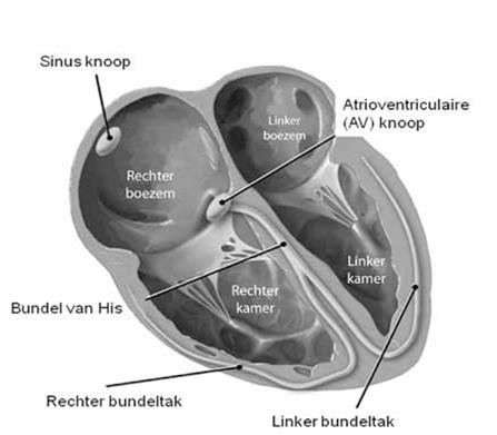 Ablatie van atriale fibrillatie - Patiëntenfolder - Erasmus MC