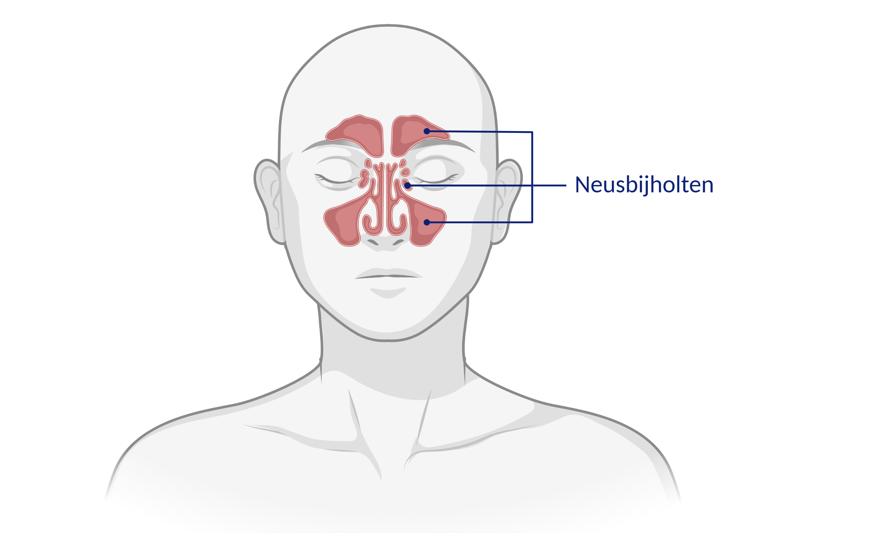 Operatie aan de neusbijholten - Patiëntenfolder - Erasmus MC