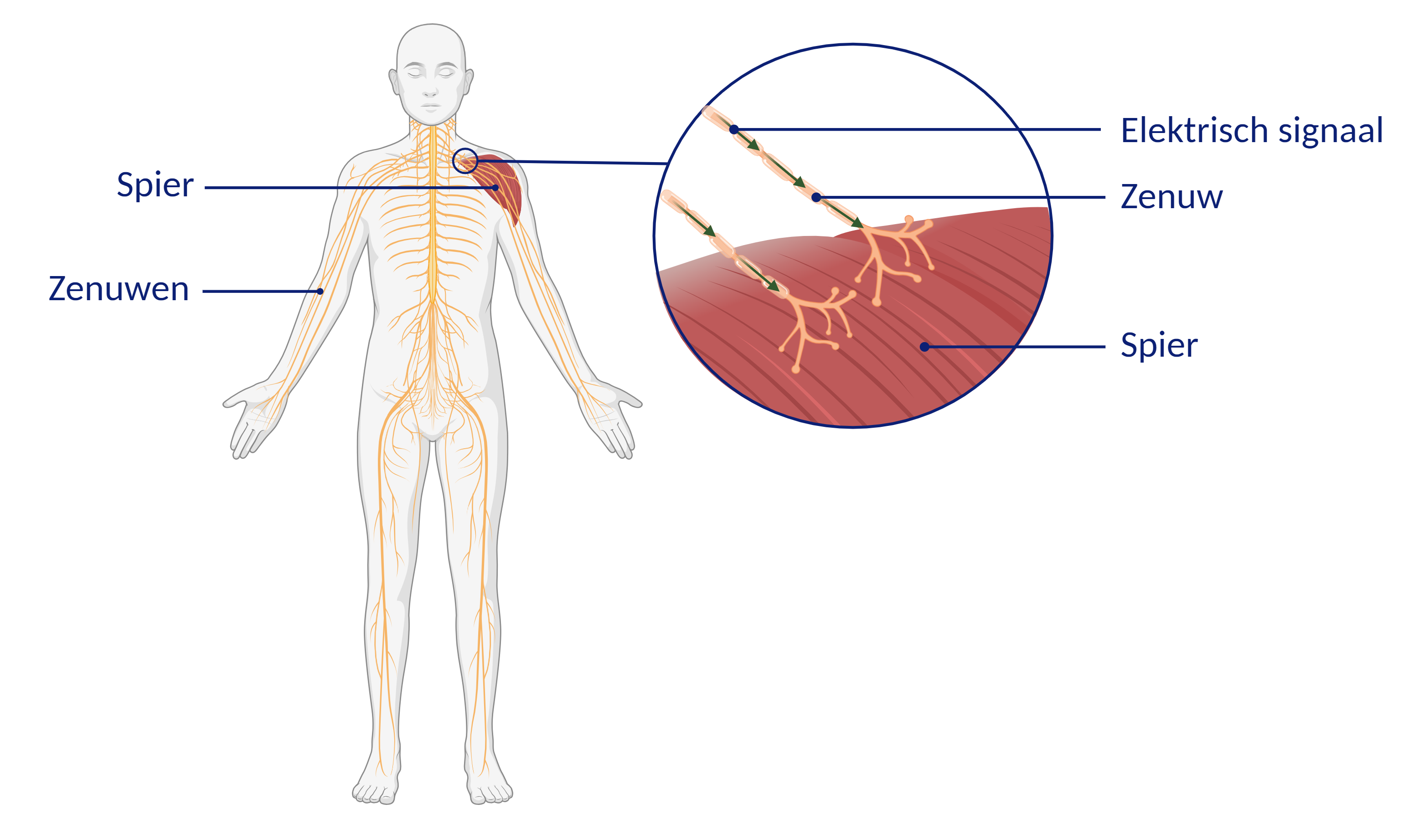 EMG - Patiëntenfolder - Erasmus MC