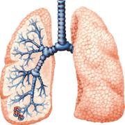 Fysiotherapie bij een proefverneveling - Patiëntenfolder - Erasmus MC