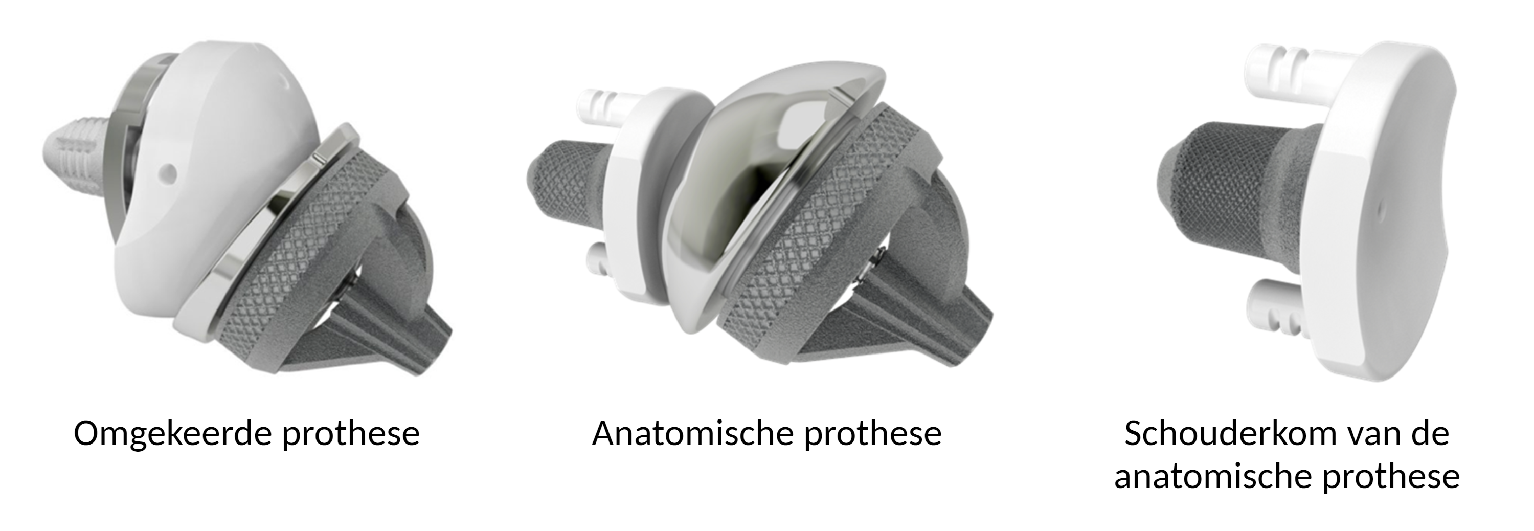 Stemless schouderprothese - Patiëntenfolder - Erasmus MC