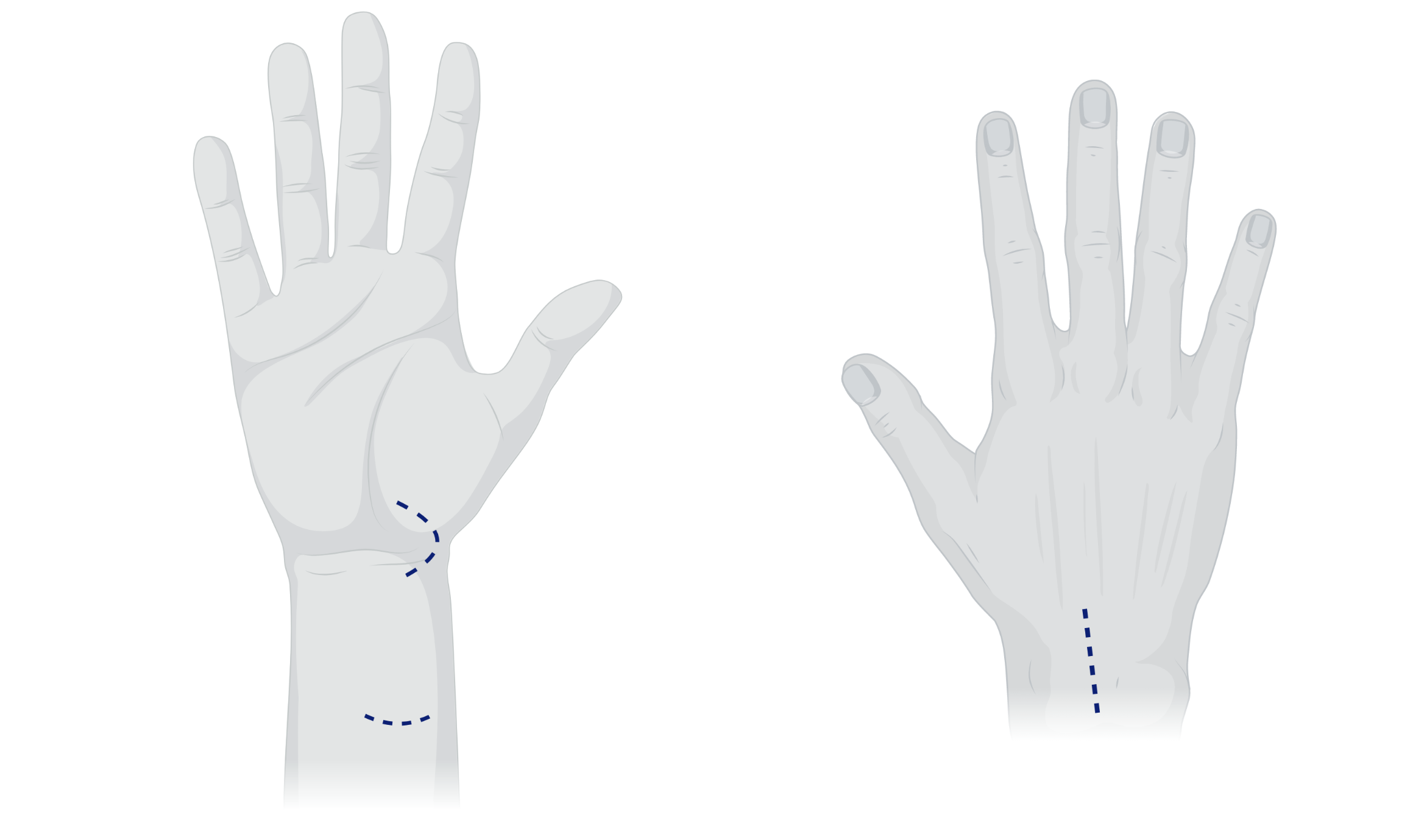 Brunelli plastiek - Patiëntenfolder - Erasmus MC