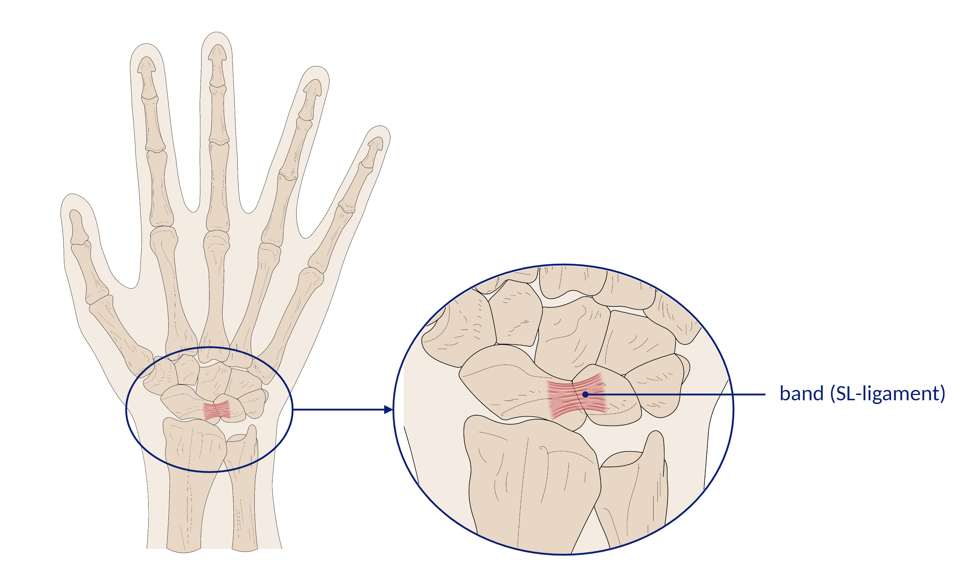 Brunelli plastiek - Patiëntenfolder - Erasmus MC