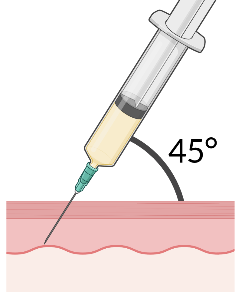 Fraxiparine-injecties geven aan uw kind - Patiëntenfolder - Erasmus MC