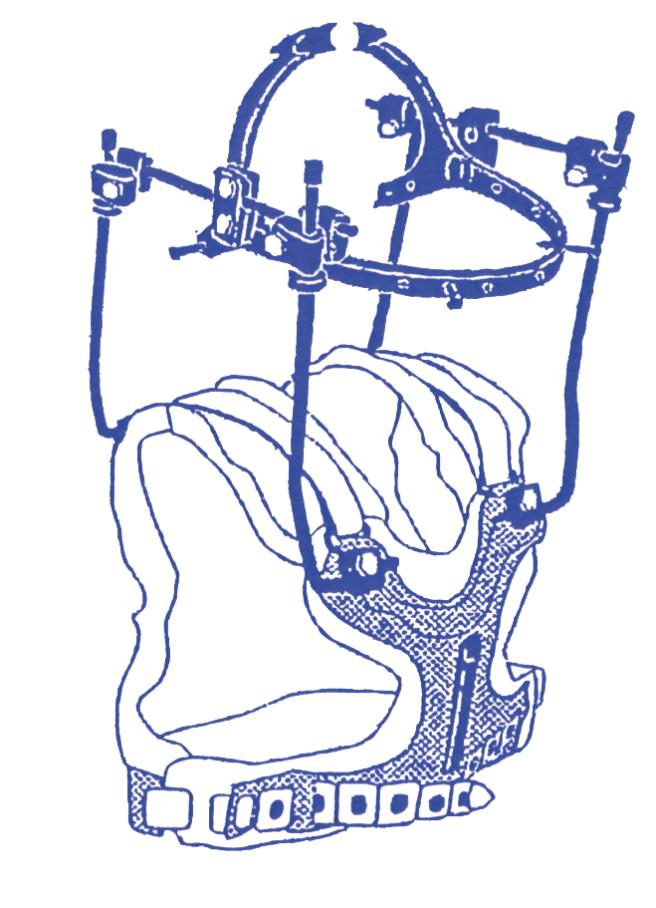 Haloframe - Patiëntenfolder - Erasmus MC