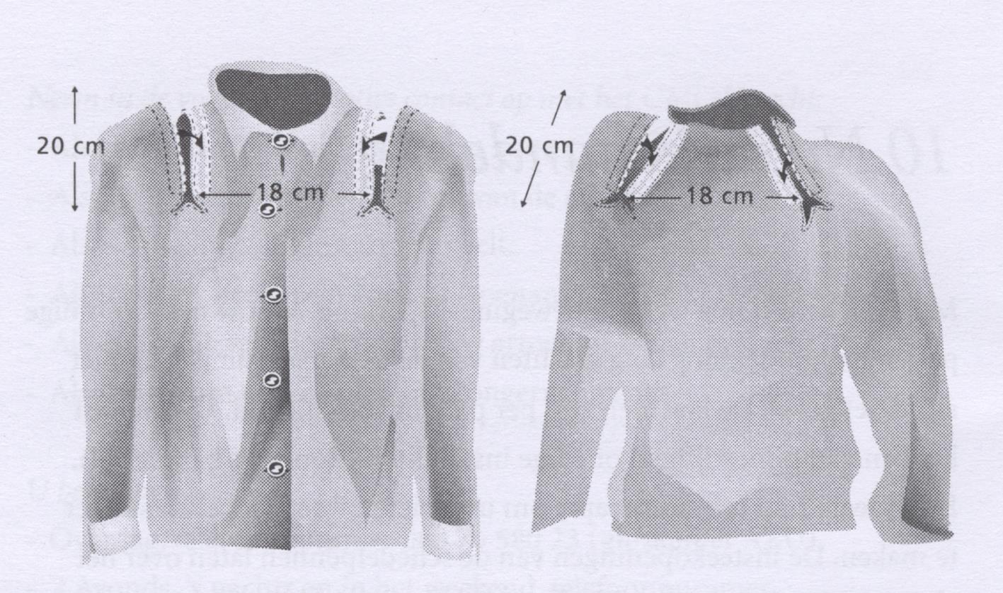 Haloframe - Patiëntenfolder - Erasmus MC